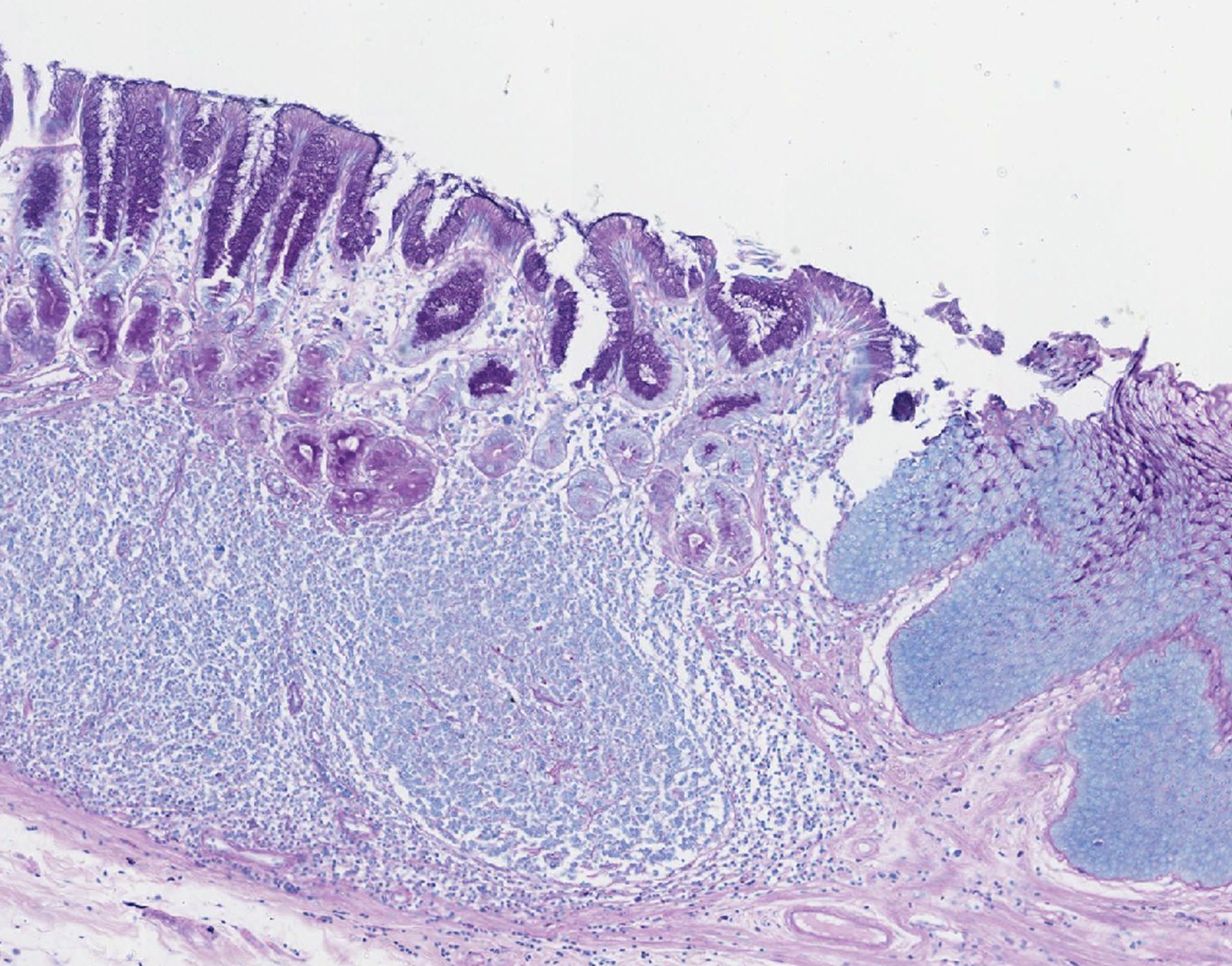 Esophagus Stomach Junction Histology Labeled Gastroesophageal Junction